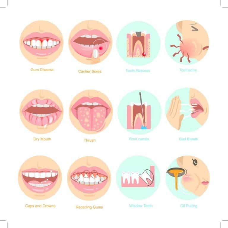 Gum Diseases - Newlife Dental Practice